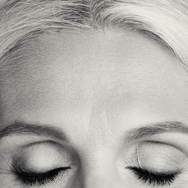 Forehead wrinkles - AgeWorth