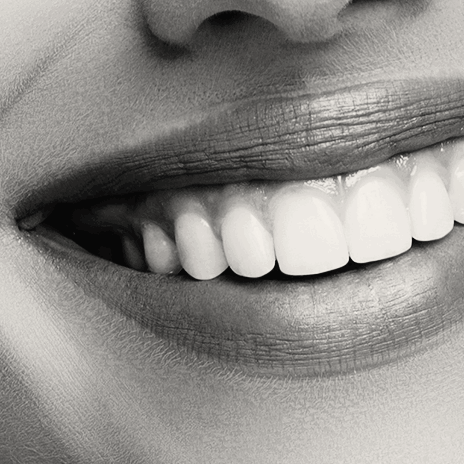 Gummy smile - AgeWorth