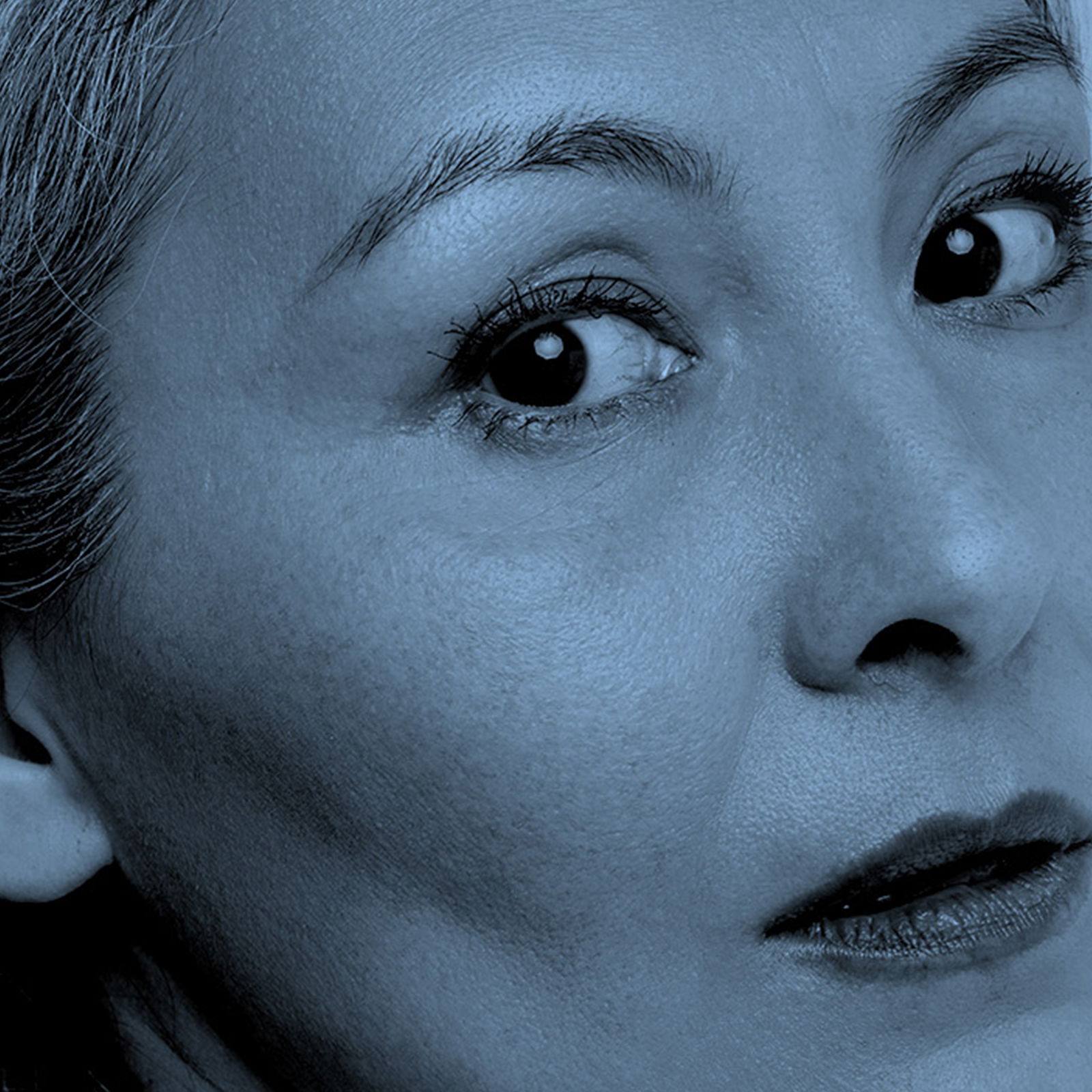 Macs Facelift - AgeWorth