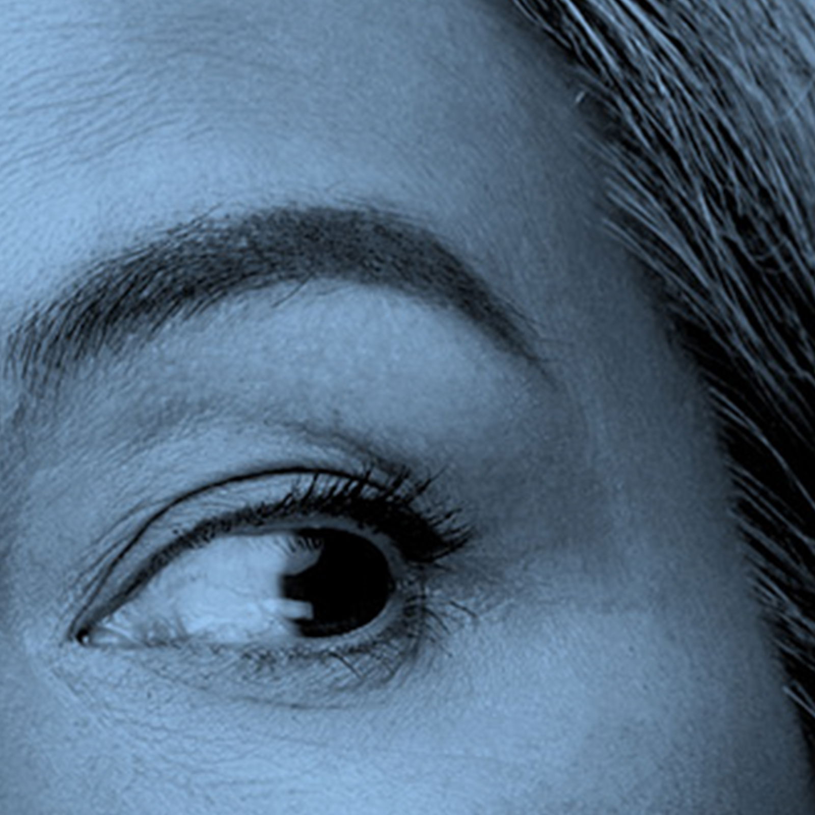 Thread lift - AgeWorth