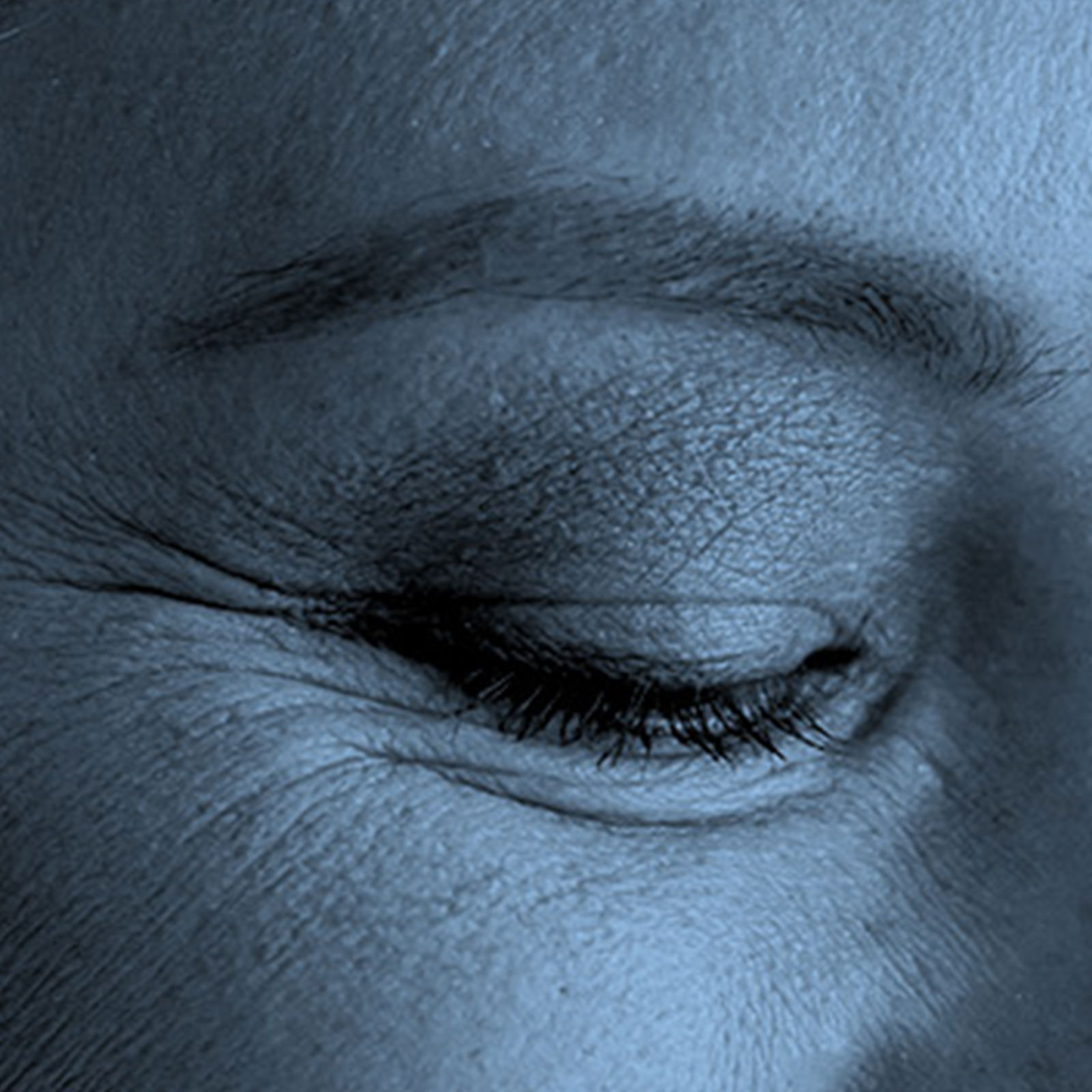 Eyelid surgery: Radiant look without drooping eyelids